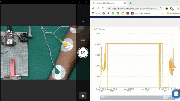 Build an IoT ECG (Electrocardiogram) System on ubidot. com - Hackster.io