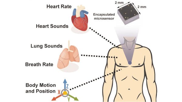 Accelerometer Contact Microphone (ACM) Sensor Offers the Best of Both ...