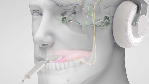 Electric Shocks, Like Pop Rocks on Your Tongue, Could Offer Relief to ...