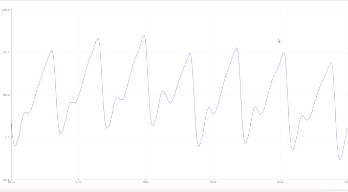 Measure Spo2 Heart Rate And Bp Trends Bpt Using Arduino Arduino