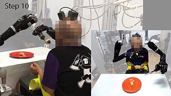 A Brain-Machine Interface and Minor Motions Allow Partially Paralyzed Patients to Feed ...
