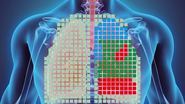 Breathing New Life Into Respiratory Monitoring - Hackster.io