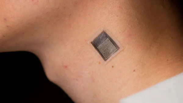 A Soft Wearable Ultrasound Sensor Peers Deep Under Your Skin to Monitor ...