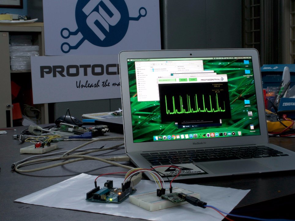 Single-lead ECG & Heartrate Variability using MAX30003 - Hackster.io