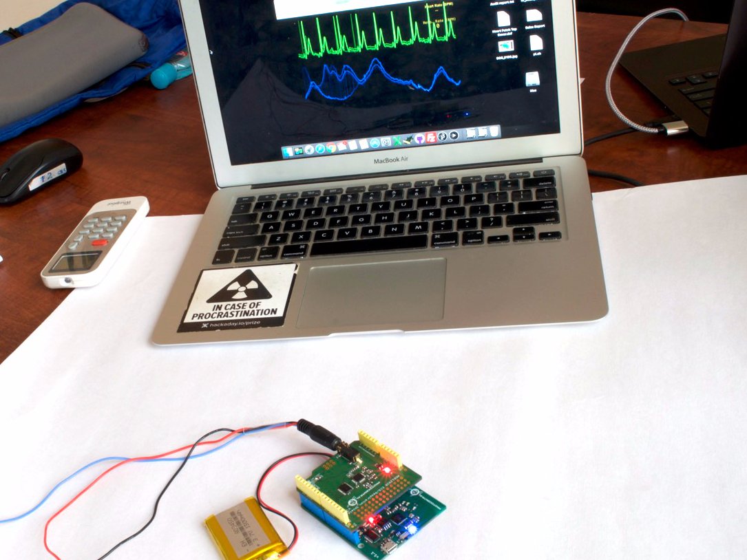 Kalam32 ESP32 Board as a Wireless WiFi/TCP ECG/Resp Monitor - Hackster.io
