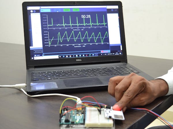 Pulse Transit Time for Cuff-less BP from ECG and PPG - Arduino Project Hub